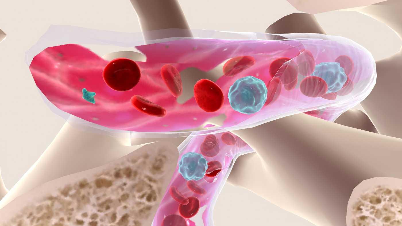 Investigational VWD Therapy to Receive Expedited Review from FDA | NBDF