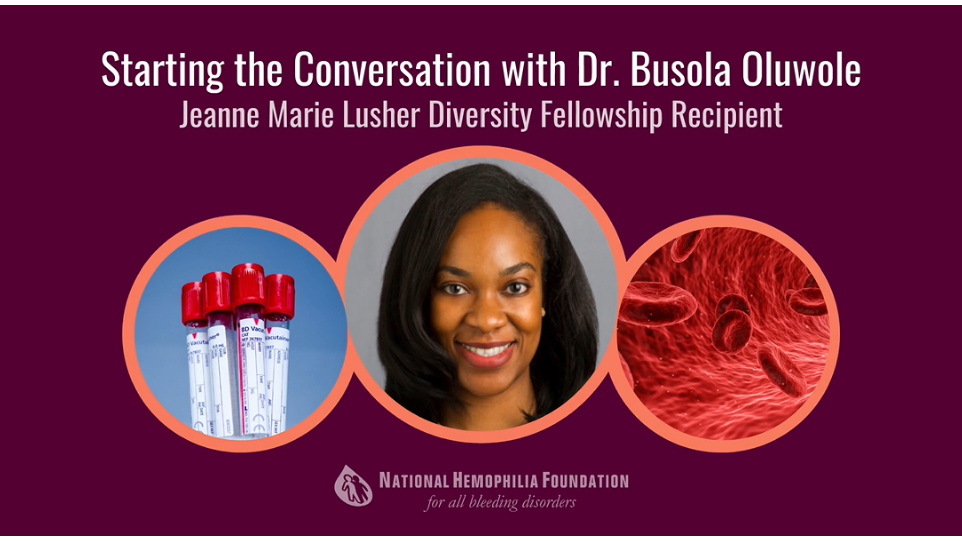 Meet Dr. Bosula Oluwole: Dedicated to Finding a Cure for Sickle Cell ...