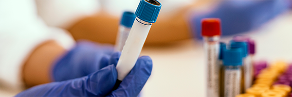 New Lab Test Screens for Inhibitors in Patients Receiving Hemlibra® | NBDF