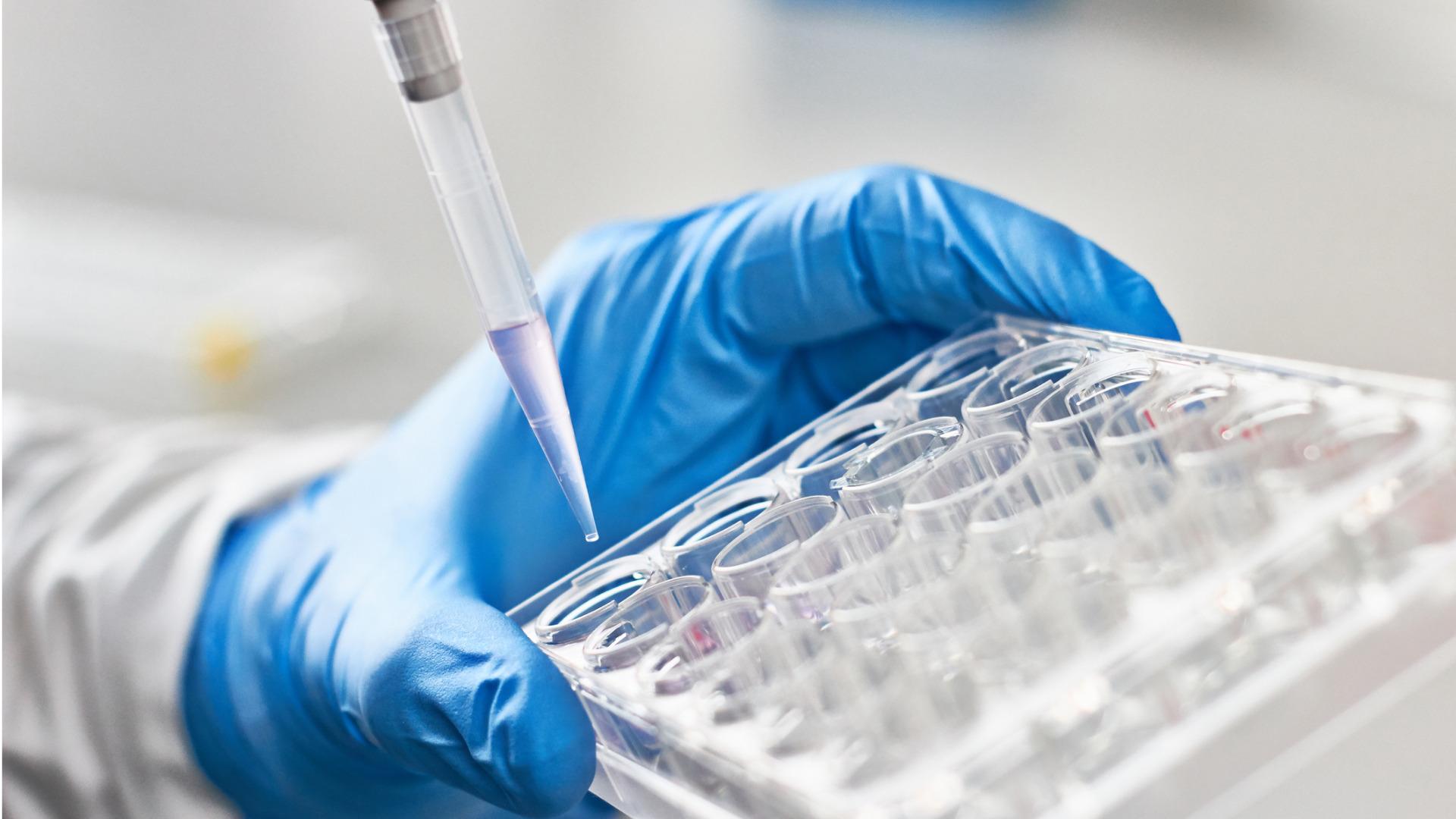 Precision BioLogic's New FIX Chromogenic Assay | NBDF